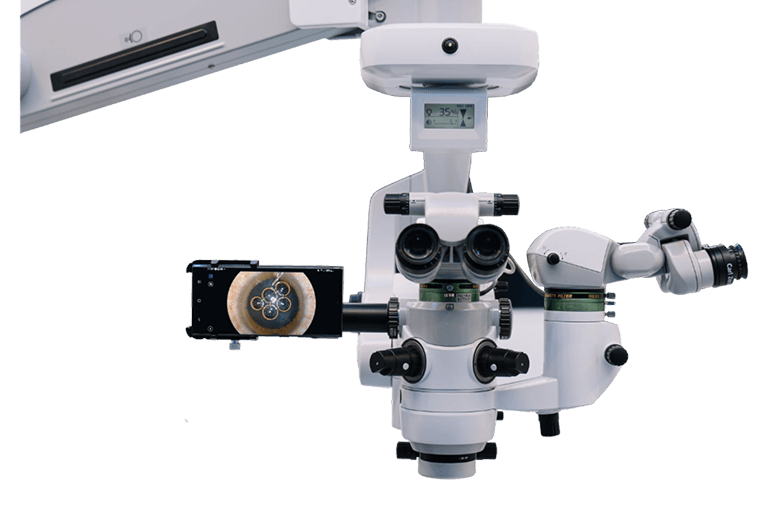 Slit Lamp and Microscope Adapter - Med Imaging - MicroREC | Custom Surgical